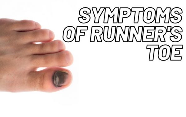 5 Ways To Prevent And Treat Runner's Toe: Get Back Running