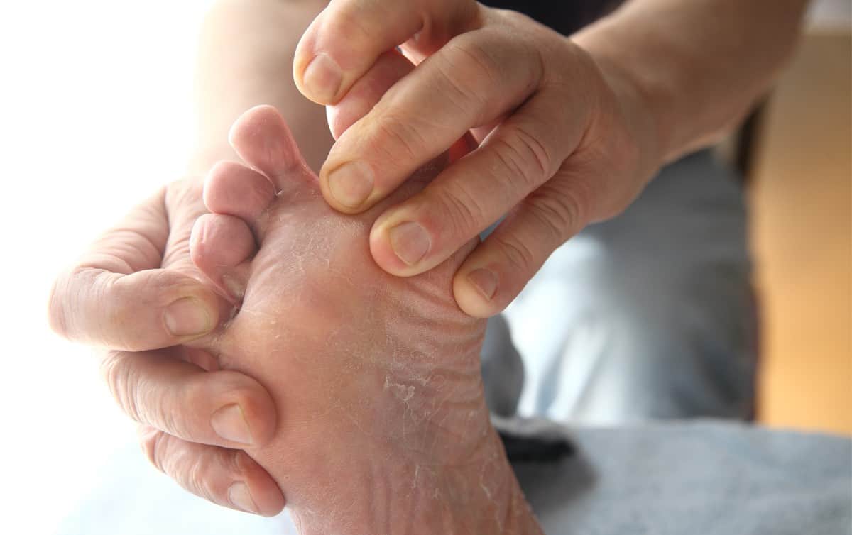 Runner's Feet: The 5 Most Common Injuries, And Foot Care For Runners