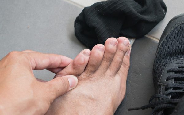 Runner's Feet: The 5 Most Common Injuries, And Foot Care For Runners