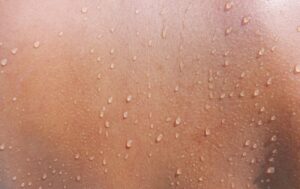 Fluid And Electrolytes For Runners: How To Hydrate Smarter And Perform ...