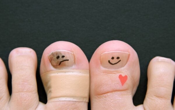 Sore Hamstrings After Running? 6 Possible Causes + Solutions