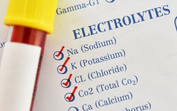 The 75 Hard Challenge: What It Is, How It Works, And How To Survive It