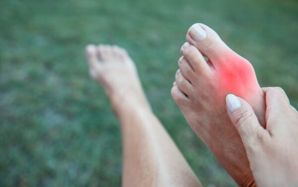Big Toe Pain From Running? Here Are 7 Possible Causes