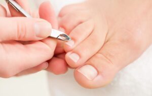 6 Ways To Stop A Toenail Falling Off From Running