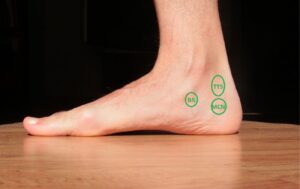 Heel Pain After Running? Here Are 10 Possible Causes + How To Fix It