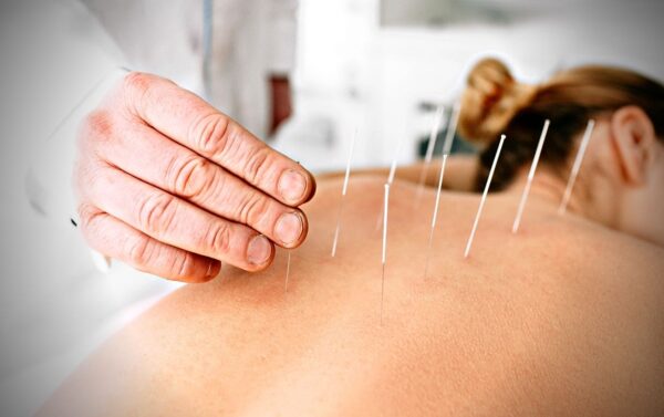 Acupuncture For Athletes: 7 Benefits + What To Expect