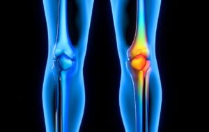 Pain Behind The Knee? 6 Common Causes + Effective Treatments