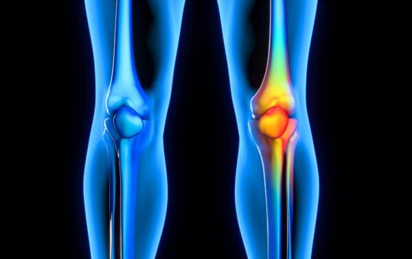 Pain Behind The Knee? 6 Common Causes + Effective Treatments