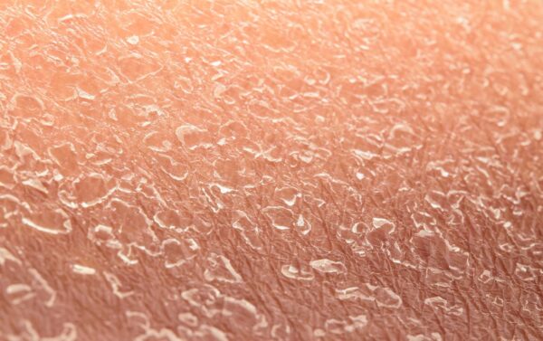 The Runner's Itch Is Real: Here's What Causes It (+ How To Treat It)