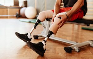 Running With A Prosthetic Leg: Everything You Need To Know