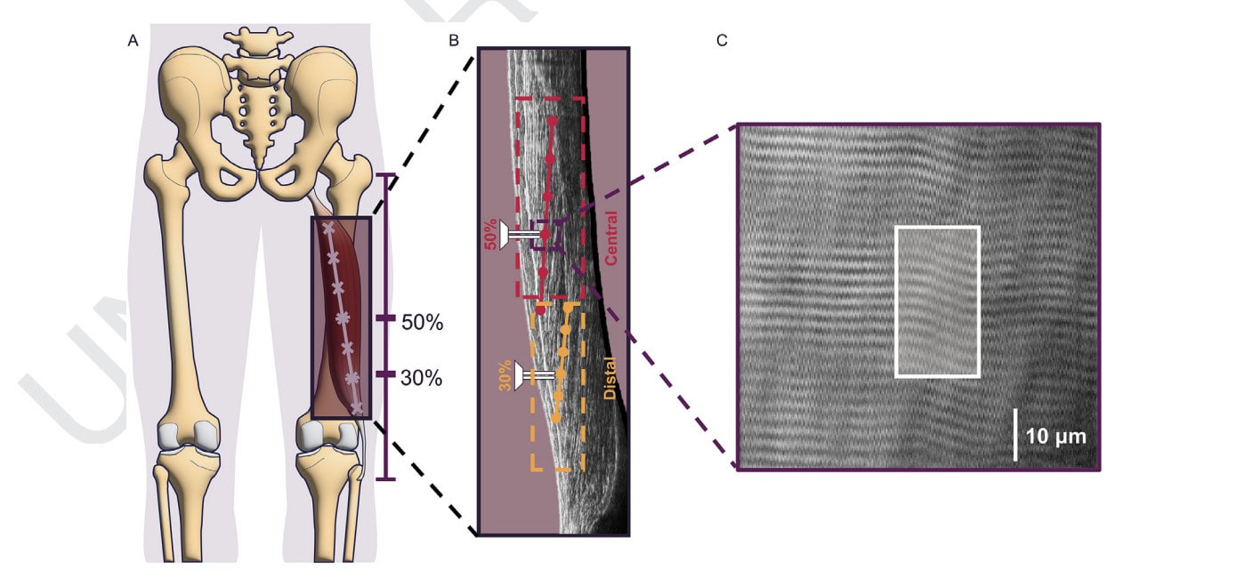 Latest Study Finds Eccentric Hamstring Training Could Be The Key To ...
