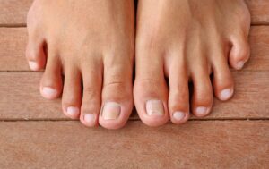 Stubbed Toe Treatment: When Do You Need To Seek Help?